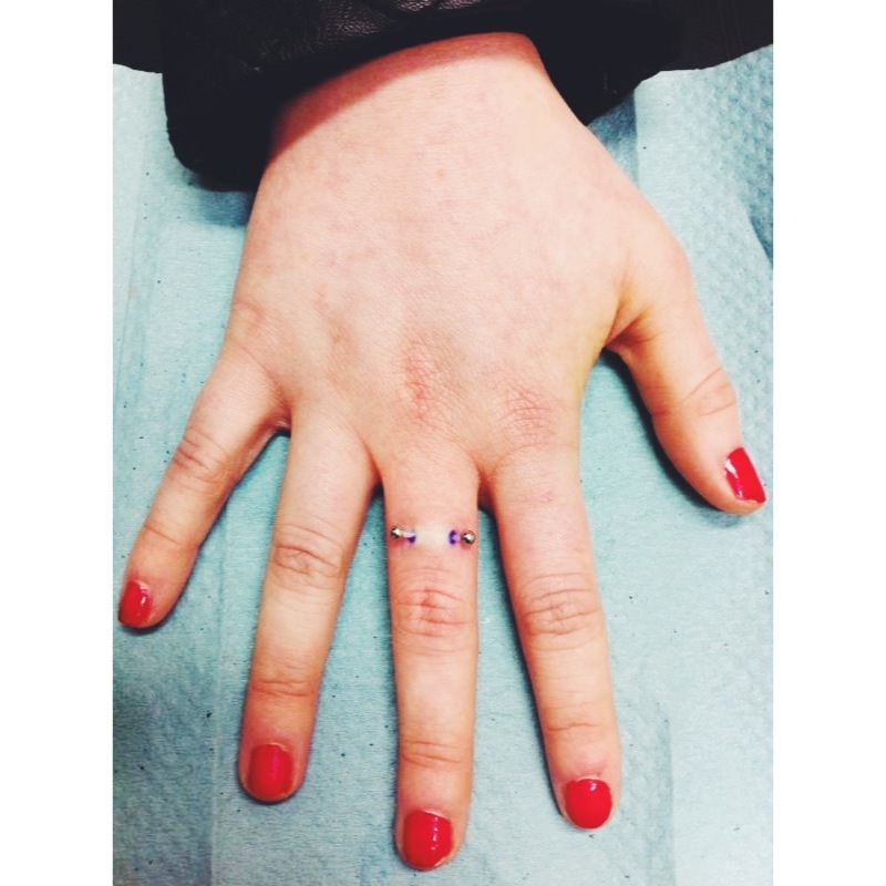 Middle Finger Surface Piercing – [ EL CAPITAN x BODY PIERCER ]
