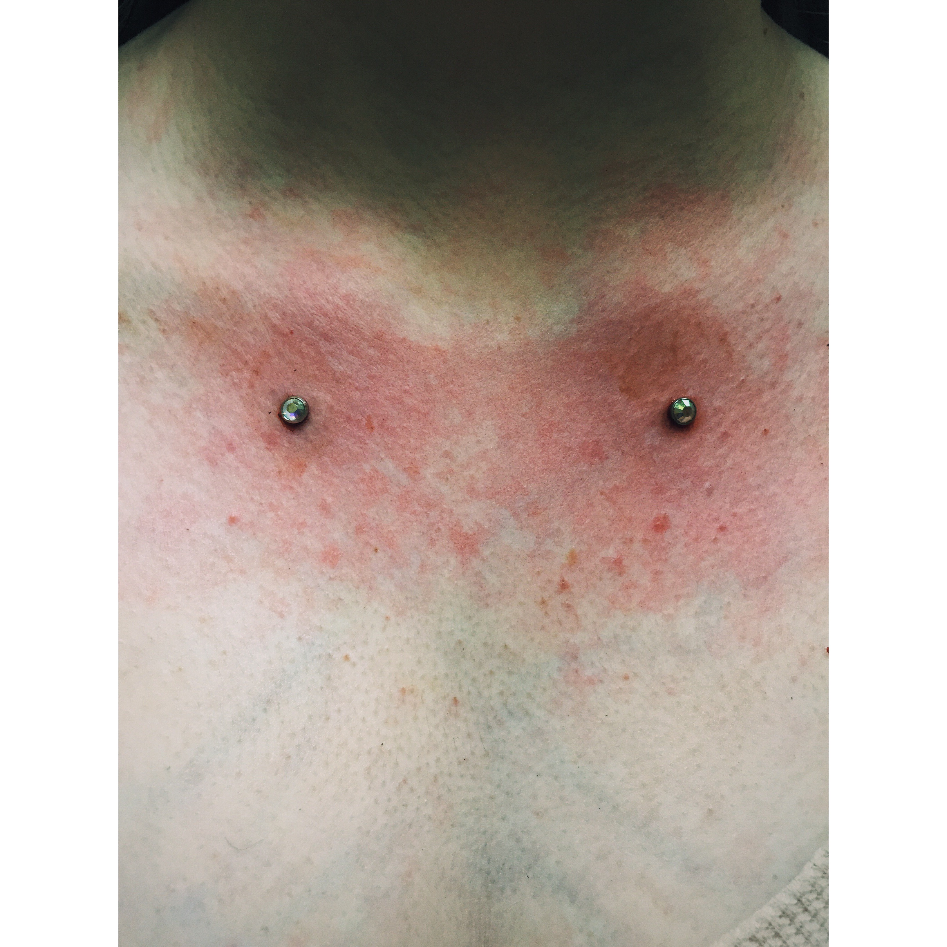 Sternum Double Dermals – [ EL CAPITAN x BODY PIERCER ]